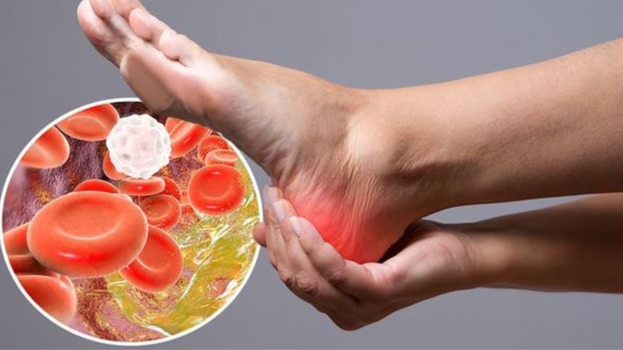 10 Super Foods for Better Blood Flow to Your Legs and Feet - YouTube