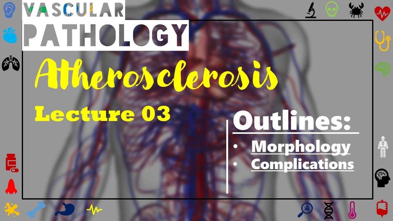 Atherosclerosis Lecture 3|Morphology of Fatty streaks or ...