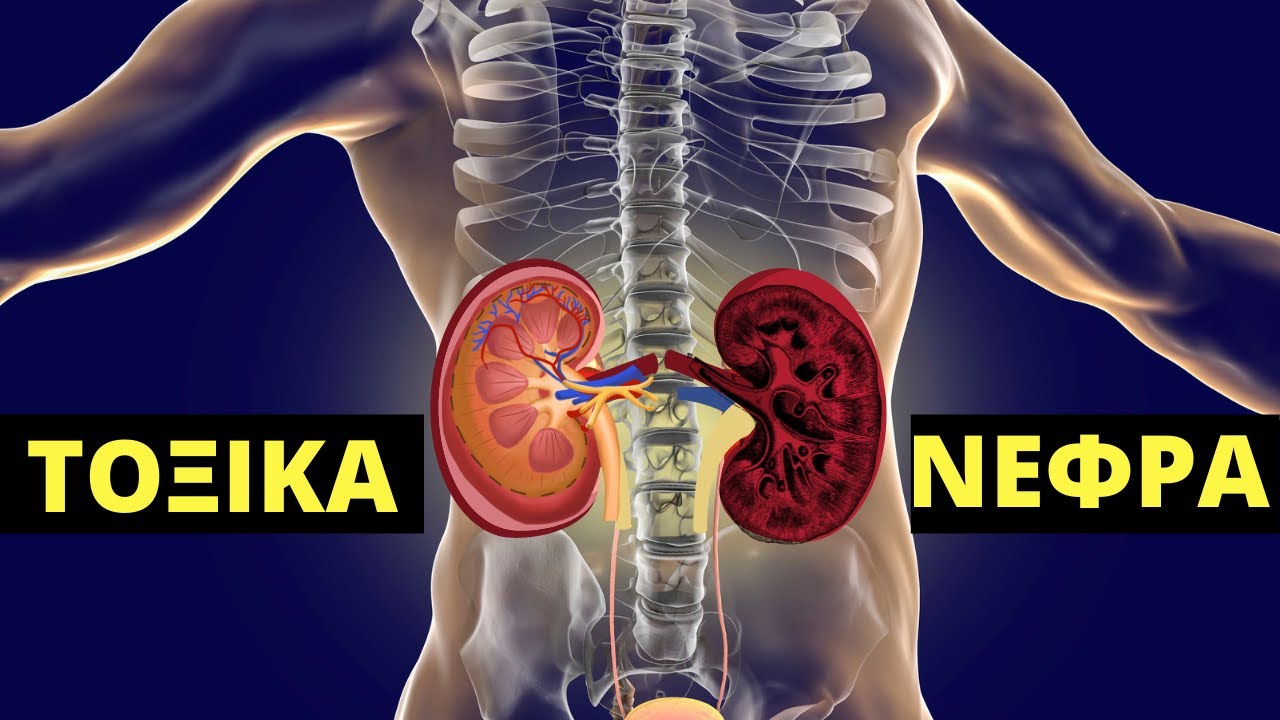 7 Προειδοποιητικά Σημάδια Ότι Τα Νεφρά Έχουν Τοξίνες! - YouTube