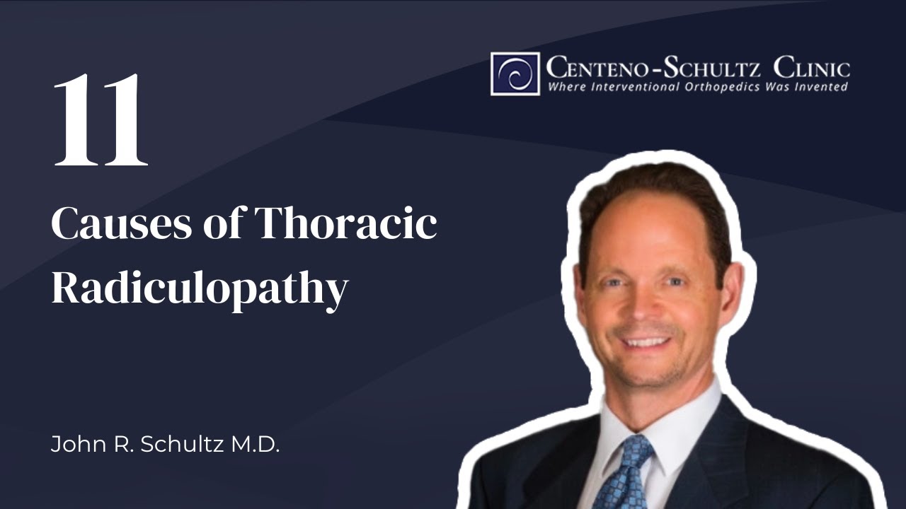 Causes of Thoracic Radiculopathy - w/ Dr. John Schultz of Centeno ...