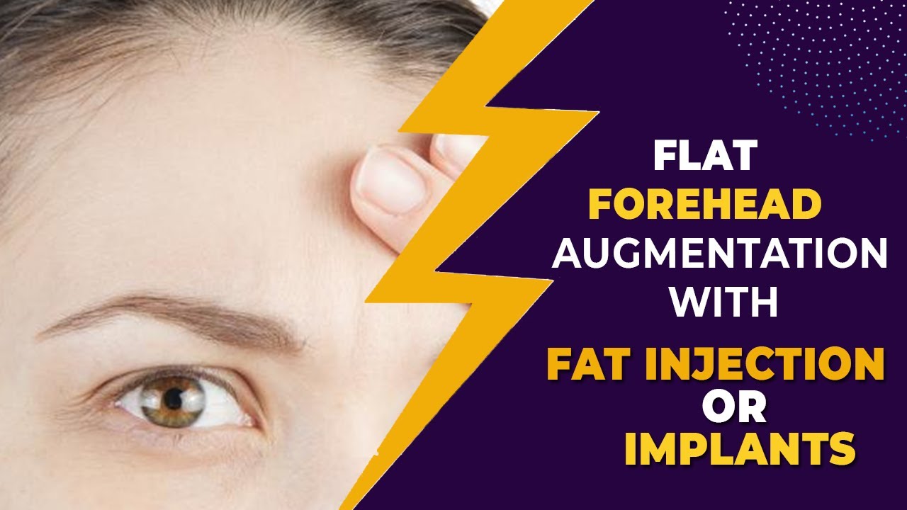 Forehead Augmentation Surgery | Flat Forehead Reshaping By Fat ...