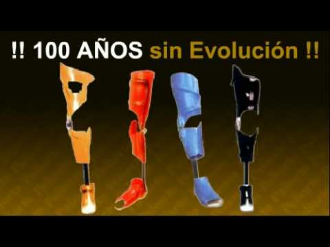 POLIORTO Composites,APARATO DE MARCHA FIBRA DE CARBONO, orthotics ...