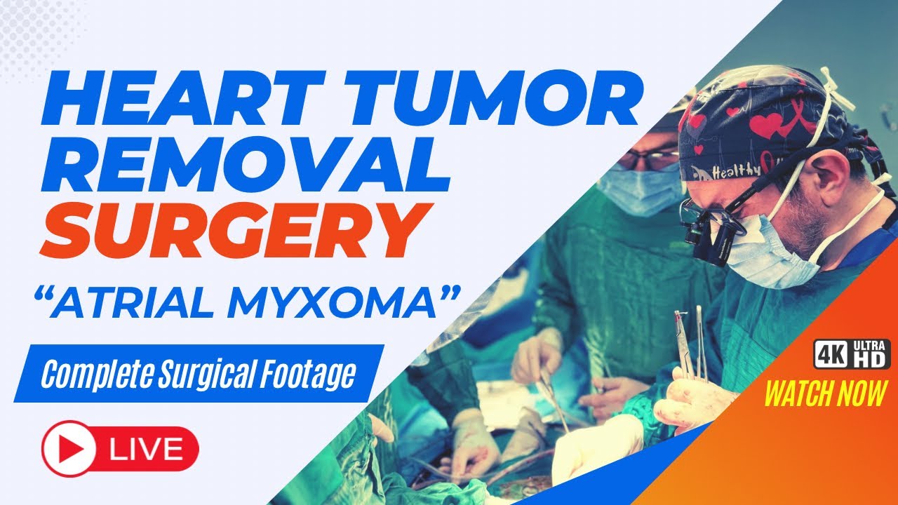 Left Atrial Myxoma Resection – Heart Tumor Removal | Open Heart Surgery ...