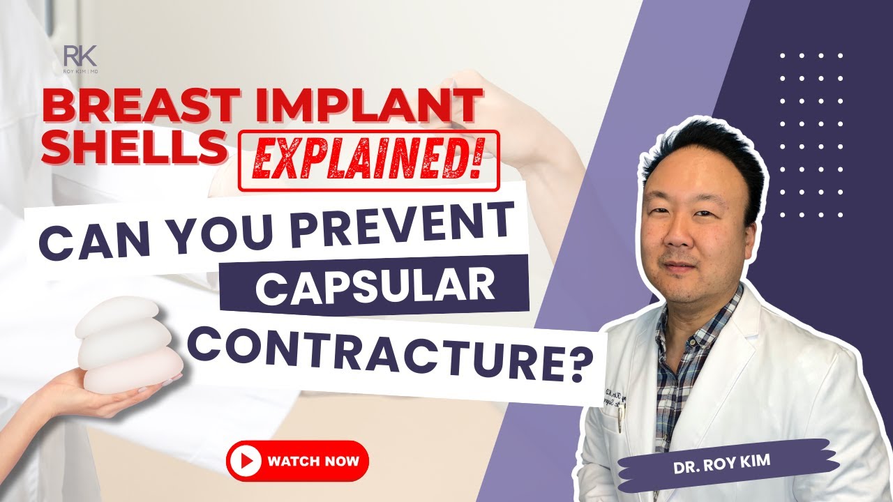 Breast Implant Shells EXPLAINED: Can You Prevent Capsular Contracture ...