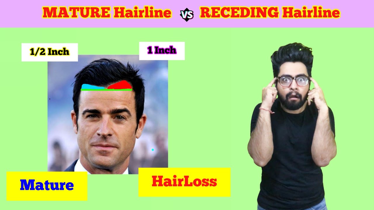Normal Hairline Vs Receding