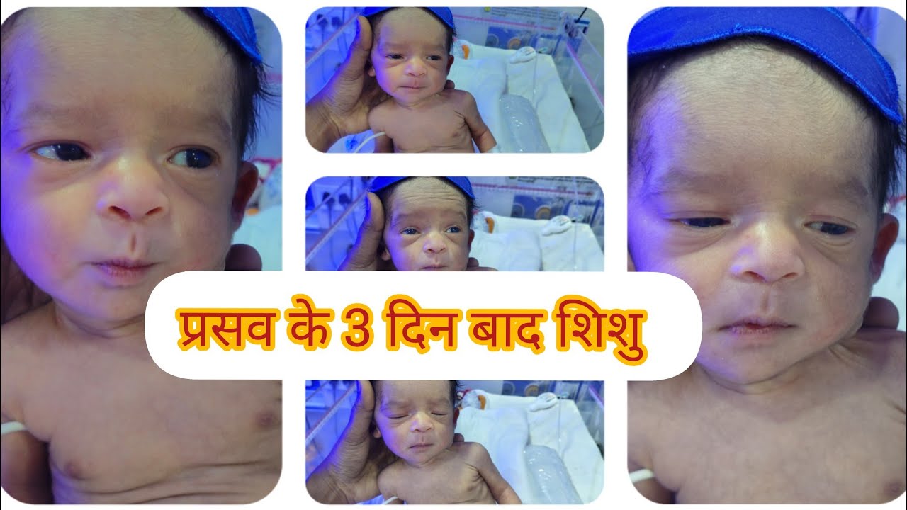 / New born baby/ After 3 days bad/baby care - YouTube