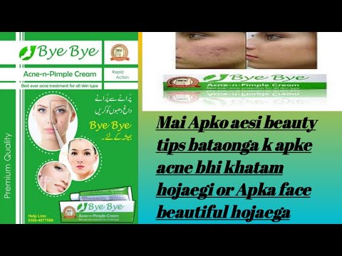 how to remove acne pimples scars on face... bye bye ACNE CREAM solution ...