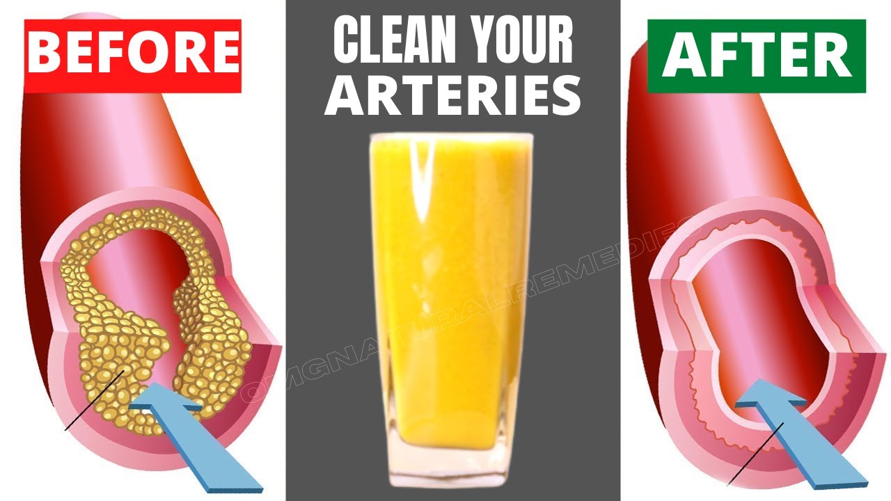 1 glass quickly unclog and clean your arteries, blood vessels enhance ...