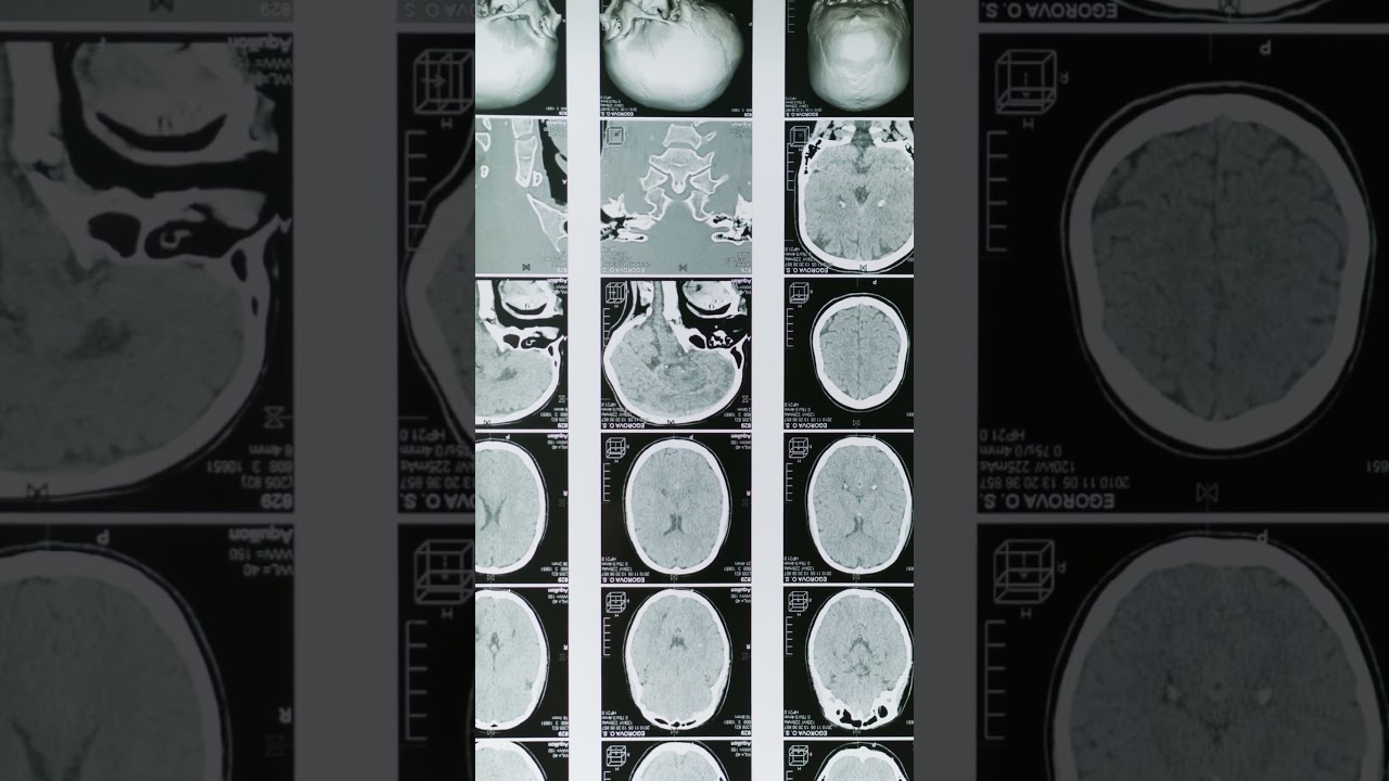 Unlocking the Brain's Curiosity Zones! #Curiosity #BrainScience # ...