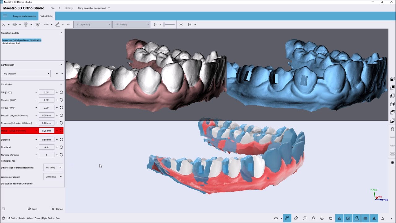Maestro 3D | Dental Studio | Virtual Setup | Models Builder - YouTube