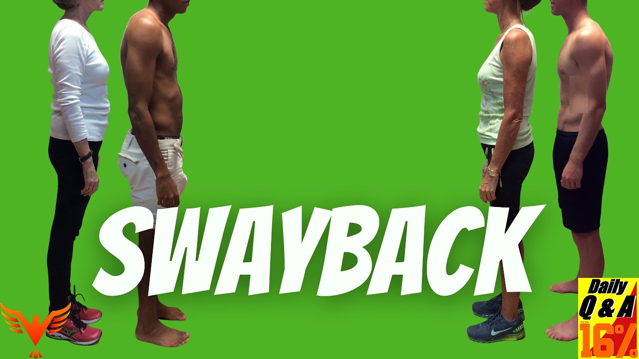 Swayback Posture - How It Evolves - BillHartmanPT.com Q&A for The 16% ...