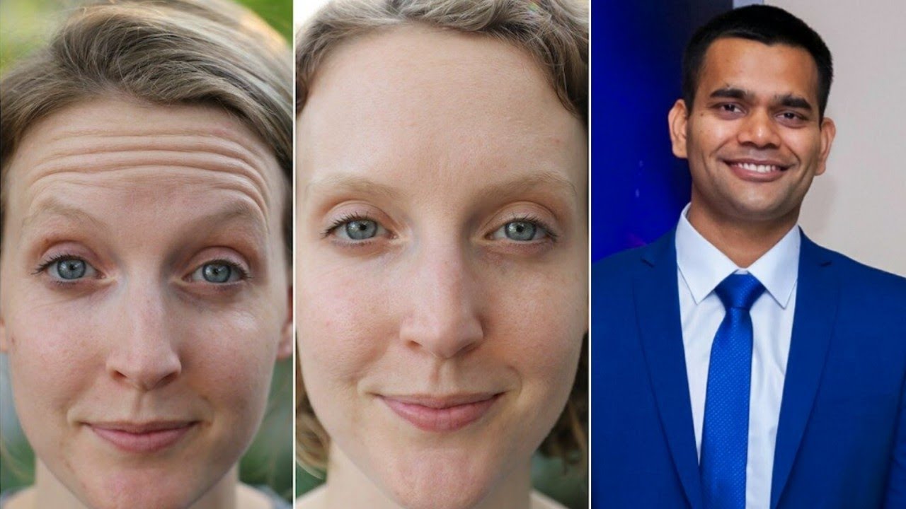 BOTOX WITHOUT INJECTIONS I MASK WITH THE EFFECT OF BOTOX. Anti age face ...