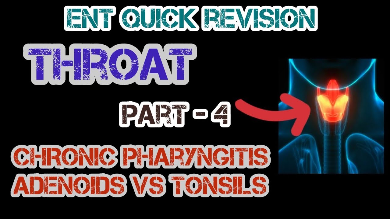 Understanding Chronic Pharyngitis: Hypertrophic vs. Catarrhal | Dr ...