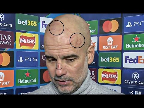Pep Guardiola had cuts on his face after Manchester City blew 3 goal ...