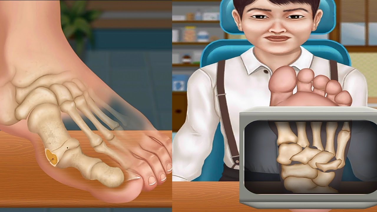 [ ASMR ] foot care animation asmr | Foot Surgery Episode 02 | Subscribe ...