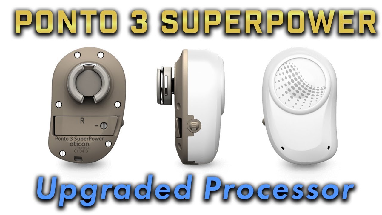 Ponto 3 Superpower - my bone anchored hearing system upgrade from ...