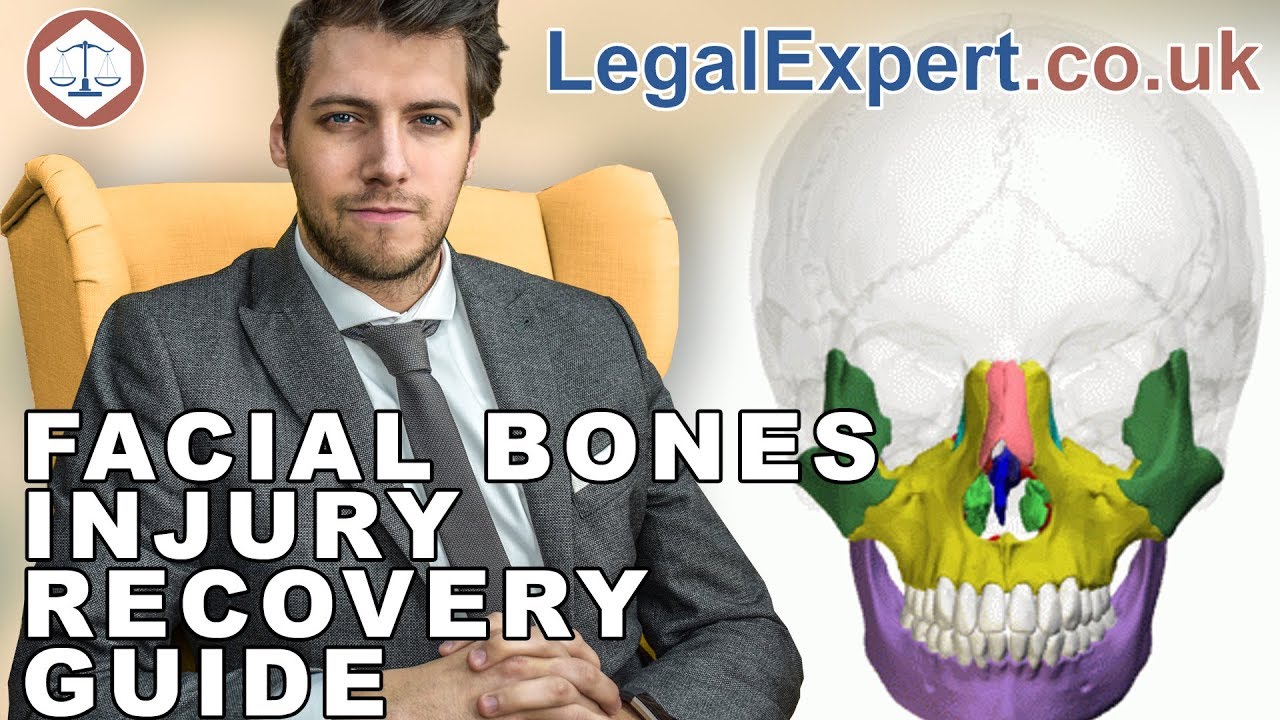 Facial Bones Injury Recovery Guide ( 2021 ) UK - YouTube