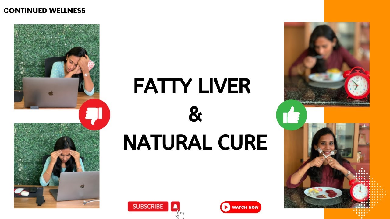 FATTY LIVER & ITS NATURAL CURE IN 3 SIMPLE STEPS . - YouTube