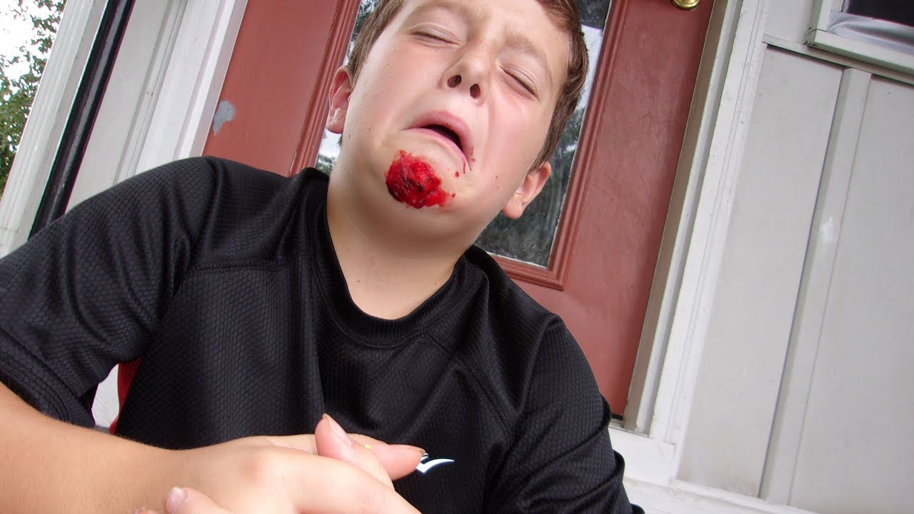 Busted Chin Prank - YouTube