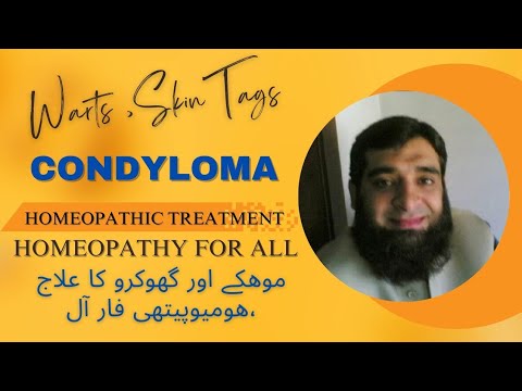 how to treat warts,skin tags & condyloma..homeopathy for all ...