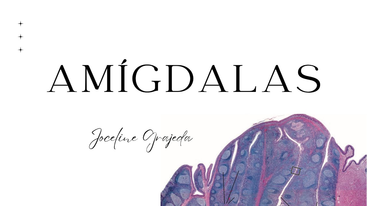 Adenoamigdalitis: ¿por qué y a quién afecta? - YouTube