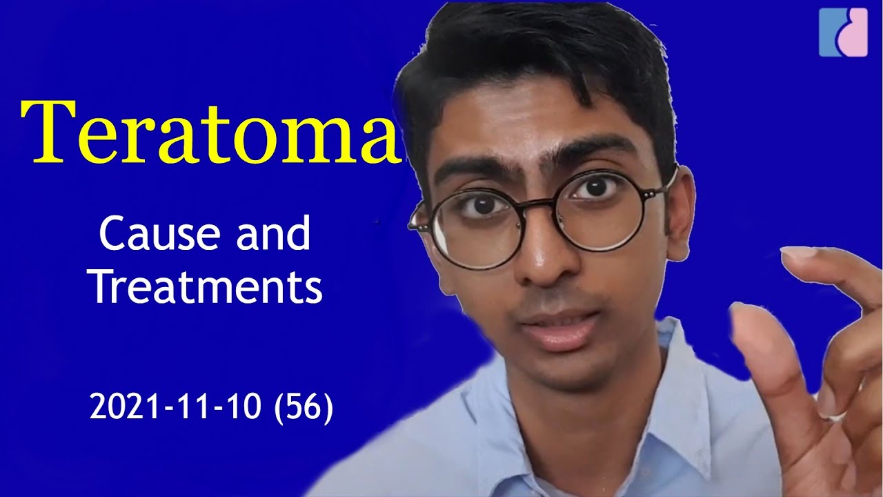 Teratoma: Cause and Treatment - YouTube