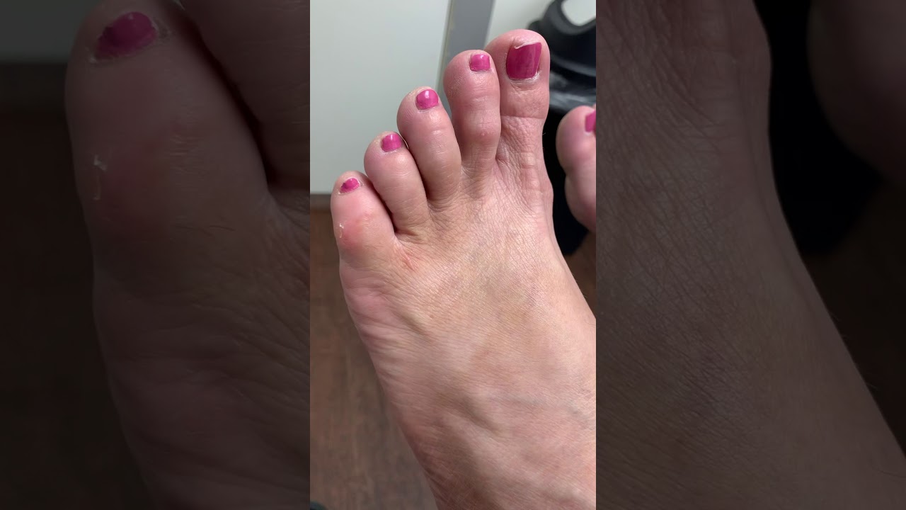 THE SAUSAGE TOE 🌭🌭🌭 - YouTube