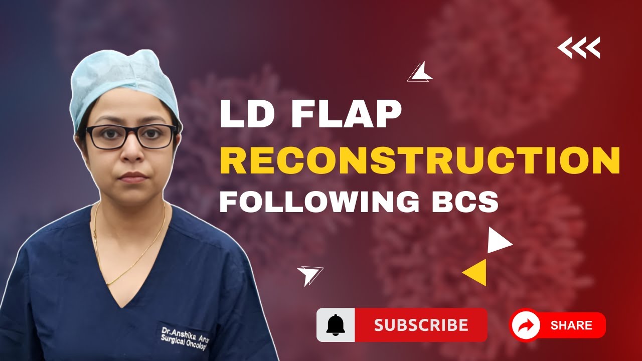 LD(latissimus dorsi) Flap Reconstruction Following BCS By Dr Anshika Arora Best Oncologist In ...