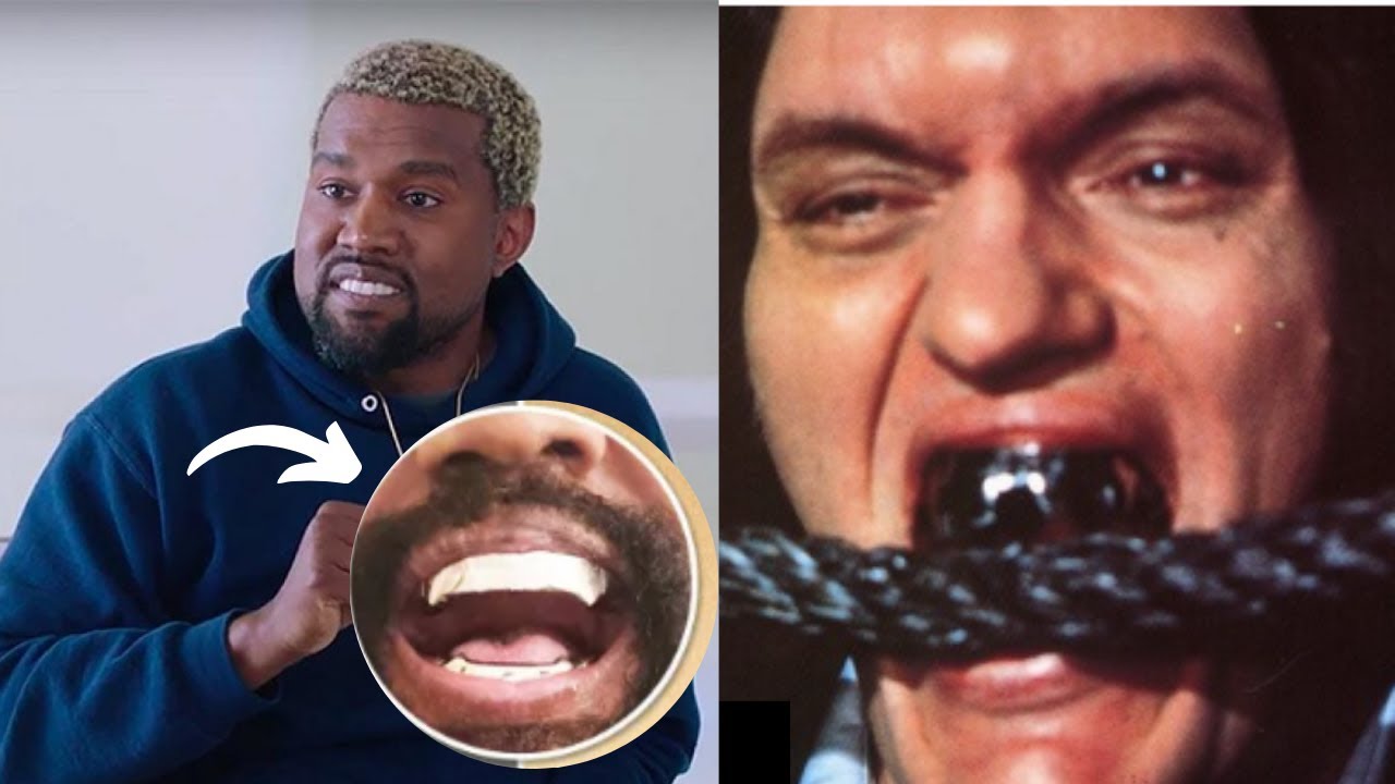 Kanye West Stuns Fans By Getting Titanium Dentures Youtube