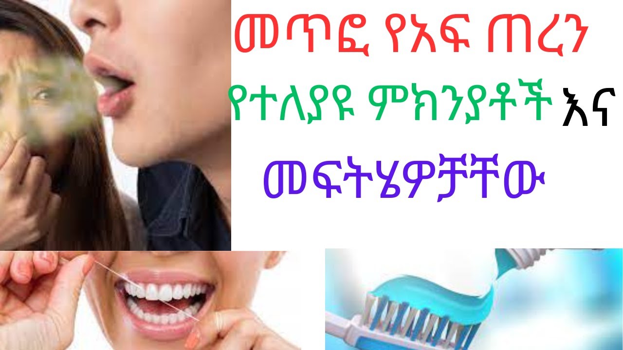 መጥፎ የአፍ ጠረን መንስኤ እና ሕክምና Youtube
