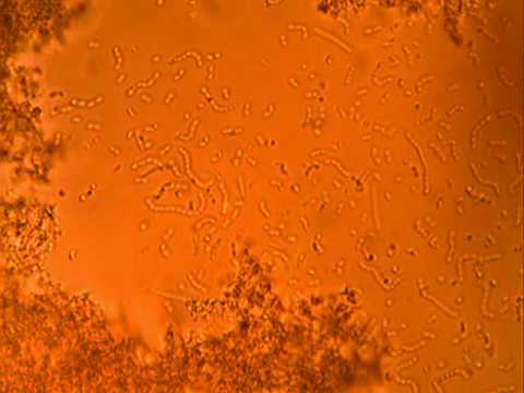 Yogurt Bacteria 1-10-09 @ 860X