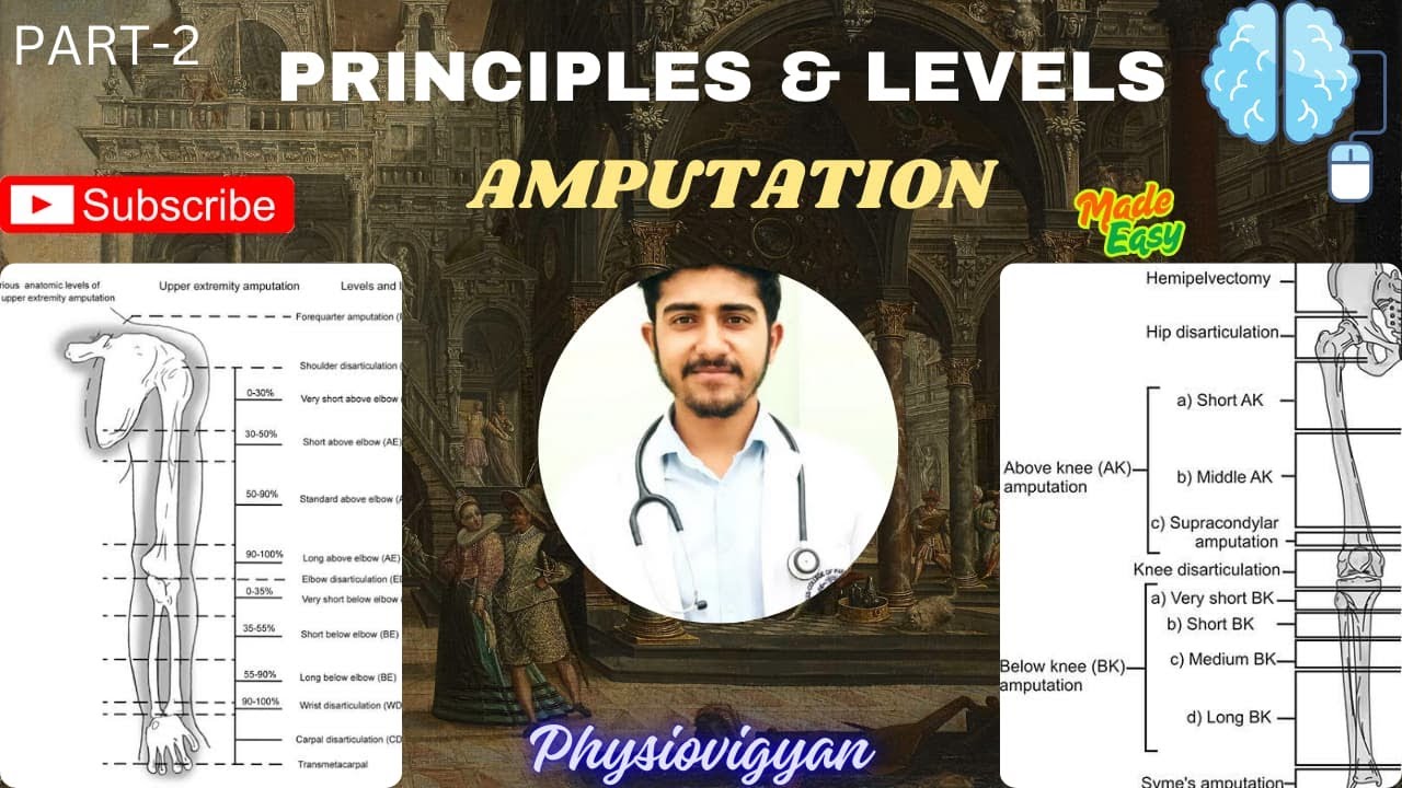 Levels of Amputation ll Principles of Amputation ll Amputation ll Types ...