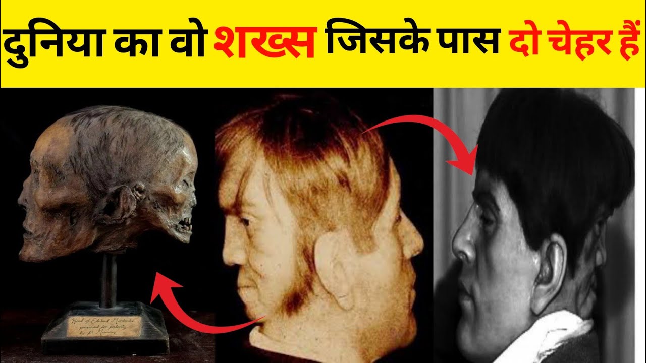 इसे अपनी जान क्यों देनी पड़ी 😭 weird man having two faces / amazing ...