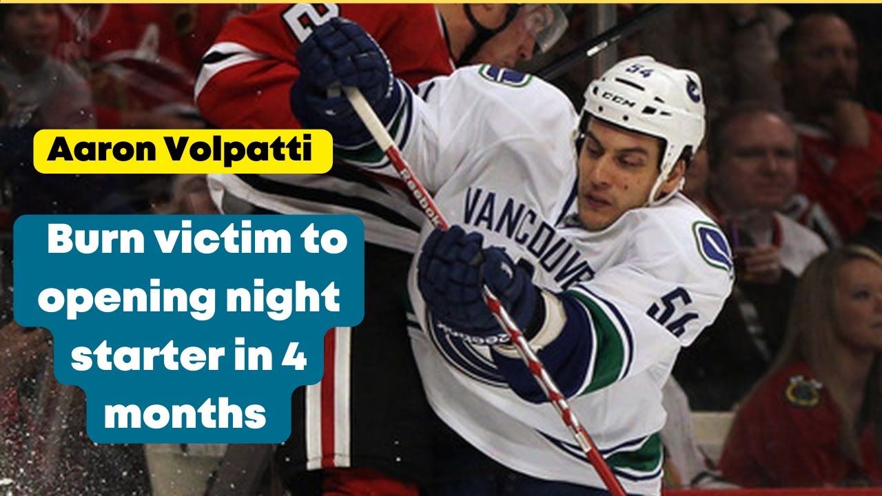 Aaron Volpatti's Burn Story - WOW! - YouTube