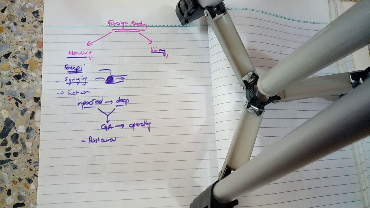 FOREIGN BODY EAR easy management and important points - YouTube