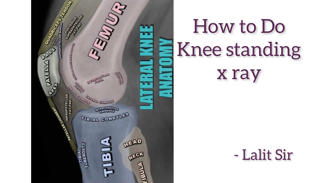 Knee Standing Ap X ray | How to do standing x ray of knee ...