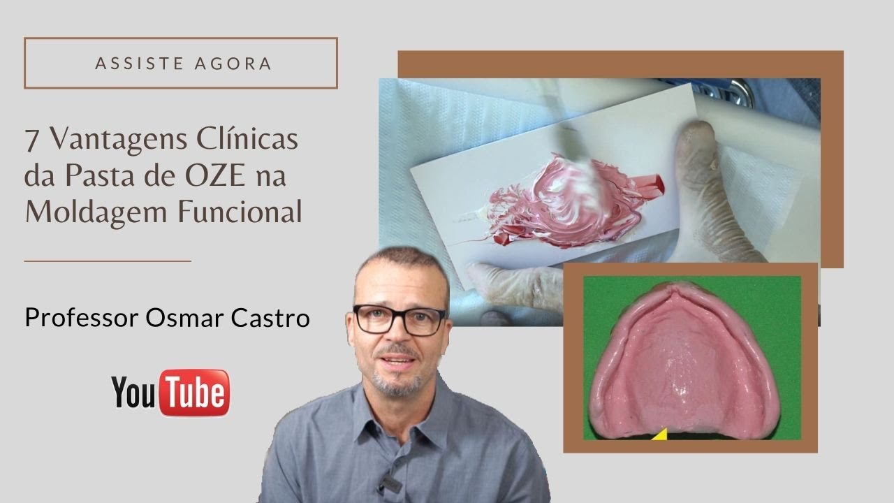 7 vantagens clínicas da pasta de OZE na Moldagem Funcional para Prótese ...