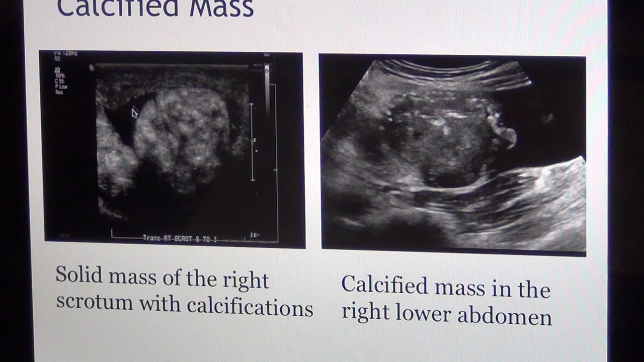 LEARN HOW TO DESCRIBE NORMAL VS ABNORMAL PATHOLOGY PART 2 - YouTube