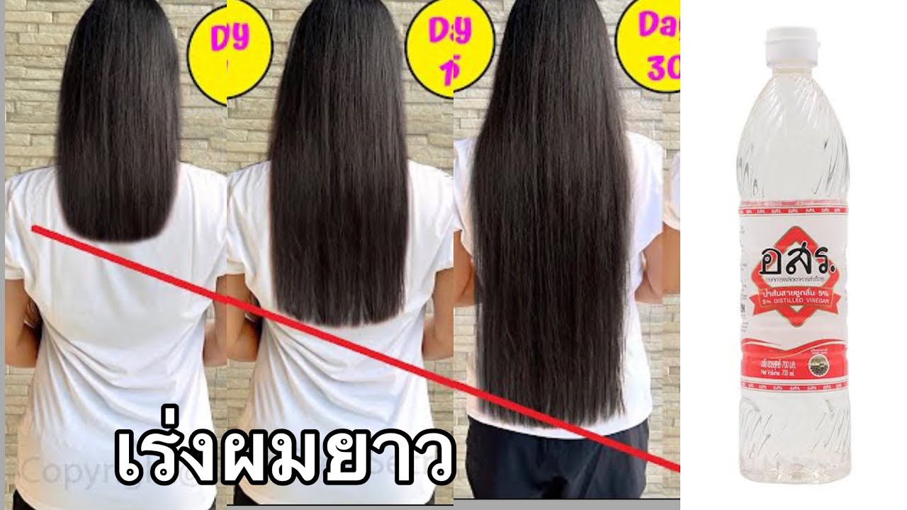 เร่งผมยาวด้วยน้ำส้มสายชู Hair Growth Hack-2 inches Hair Growth in 1 ...