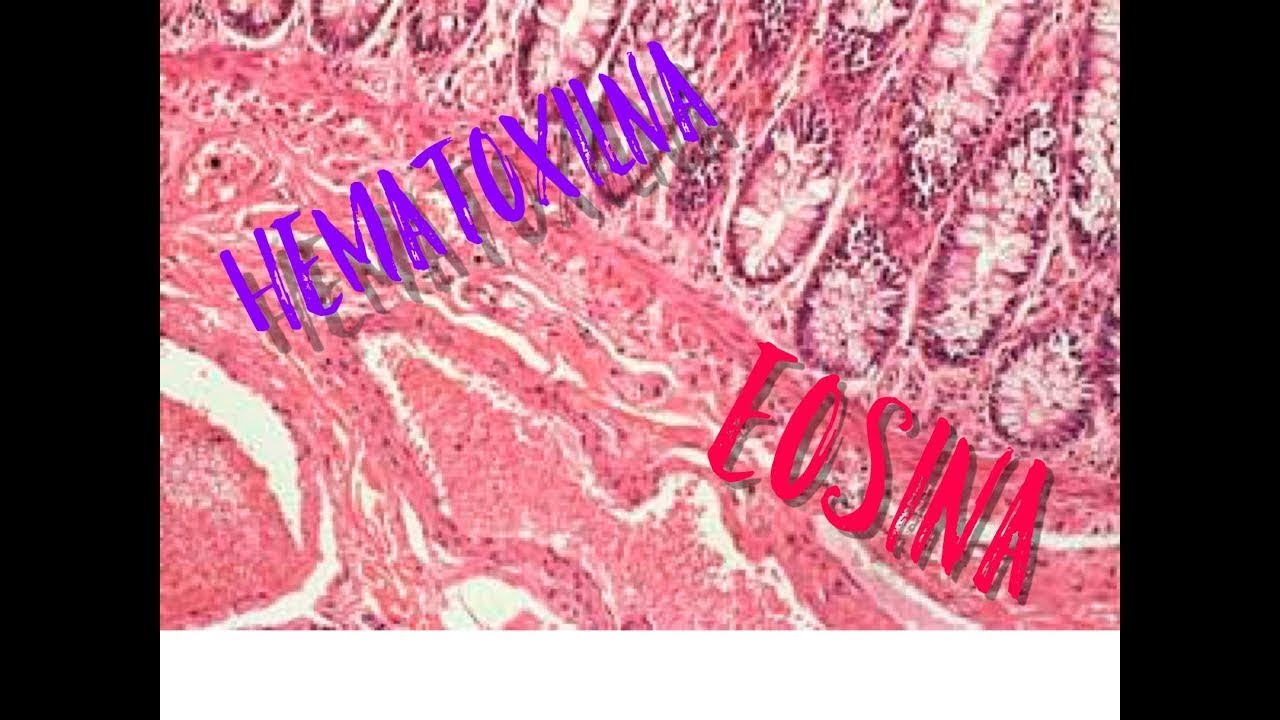 Tinción hematoxilina-eosina - YouTube