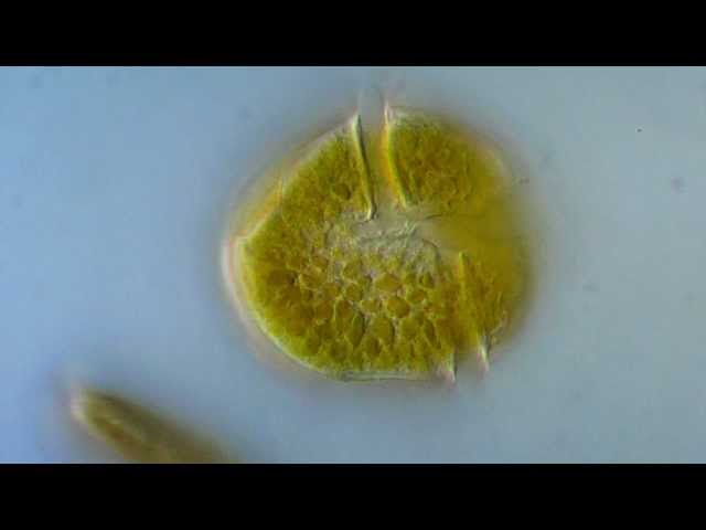 Peridinium Under Microscope
