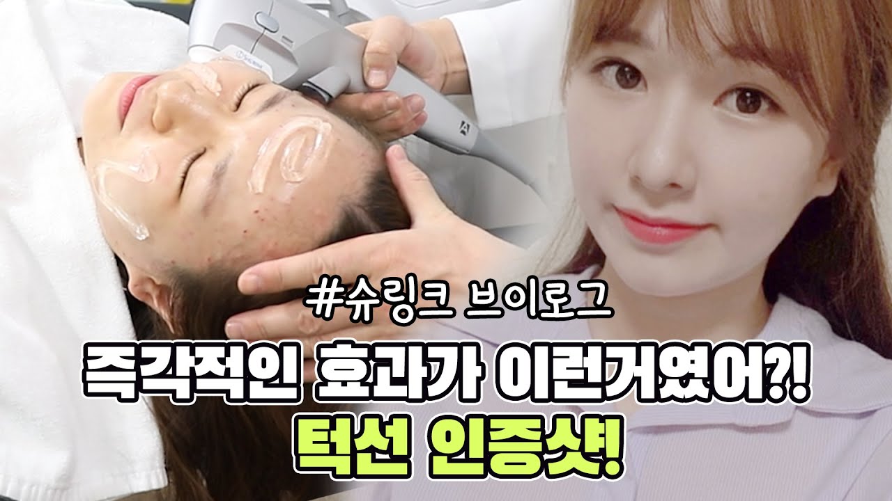생애 첫 슈링크 Vlog 슈링크 효과 못보신 분들이 꼭 보셔야 해요 💖즉각적인 효과가 이런거였어 턱선 인증샷 스킨보톡스브이라인이중턱제거물광피부 쀼