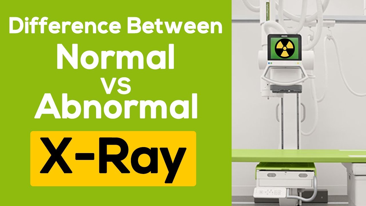 Difference between normal and abnormal (X-Ray)-স্বাভাবিক এবং অস্বাভাবিক ...