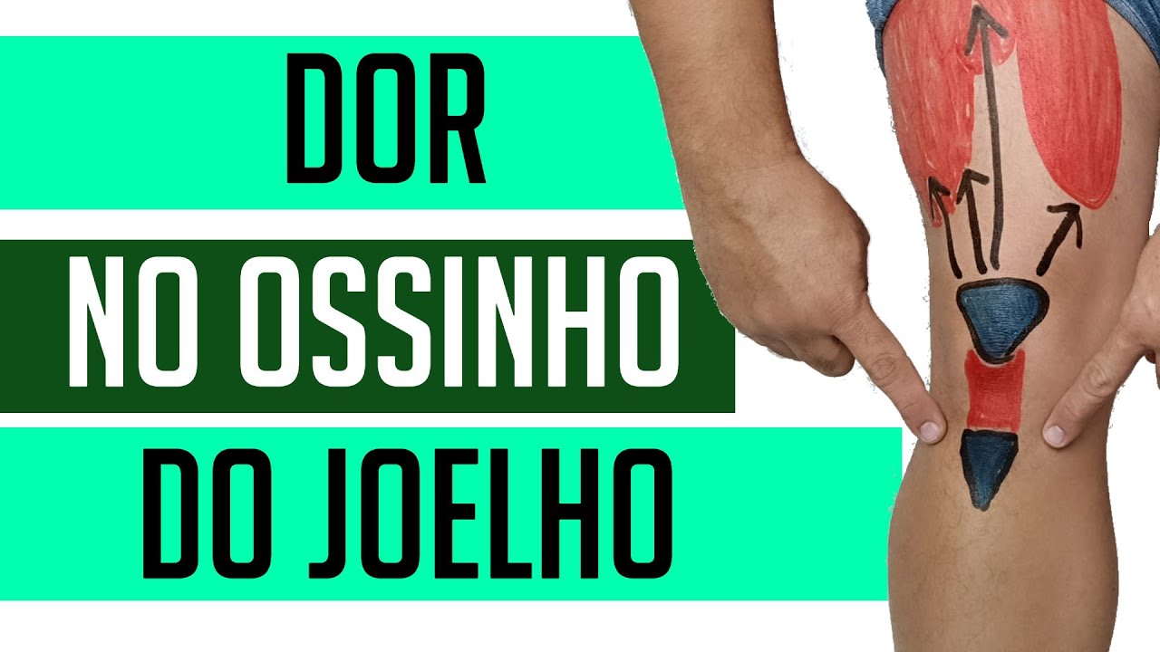 Diagrama Da Doenca De Osgood Schlatter