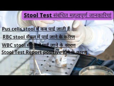 Stool Test से सम्बंधित महत्त्वपूर्ण जानकारी| pus, mucus, RBC, WBC cells ...