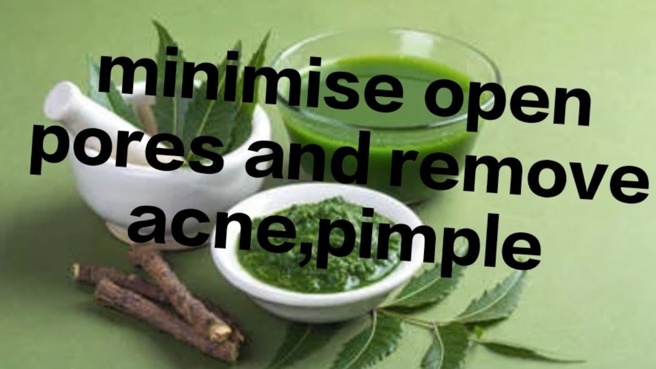 Minimise open pores and remove acne pimple ! teenager - YouTube