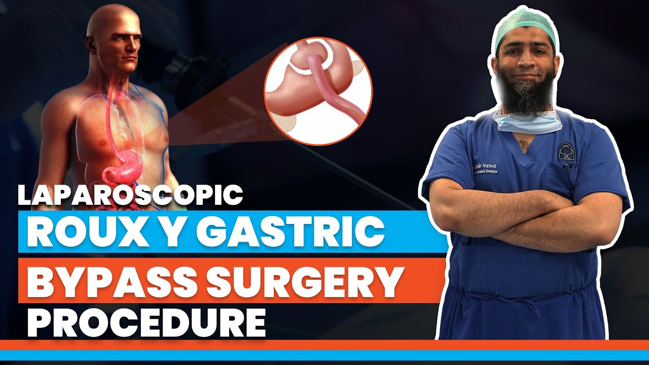 Laparoscopic Roux-y Gastric Bypass Surgery Video Explained Step by Step ...