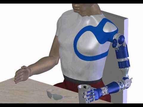 Prosthetic Arm Animation - YouTube
