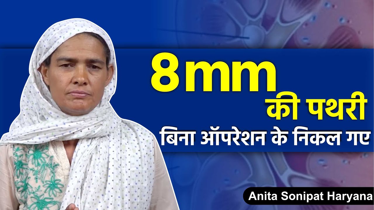8 MM की पथरी बिना ऑपरेशन के निकल गए || Anita Sonipat Haryana || Sant ...