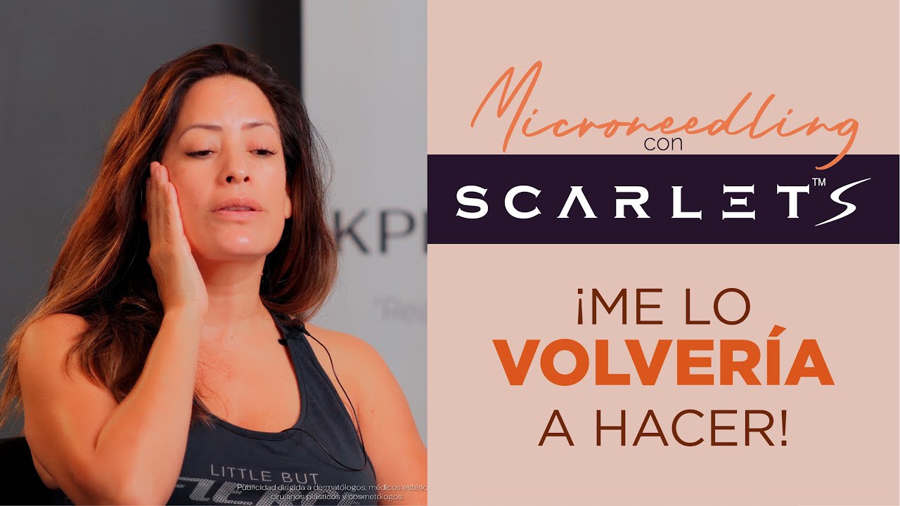 TRATAMIENTO SCARLET S BY KPI BEAUTY ⏐ ¡RESULTADOS GARANTIZADOS! - YouTube